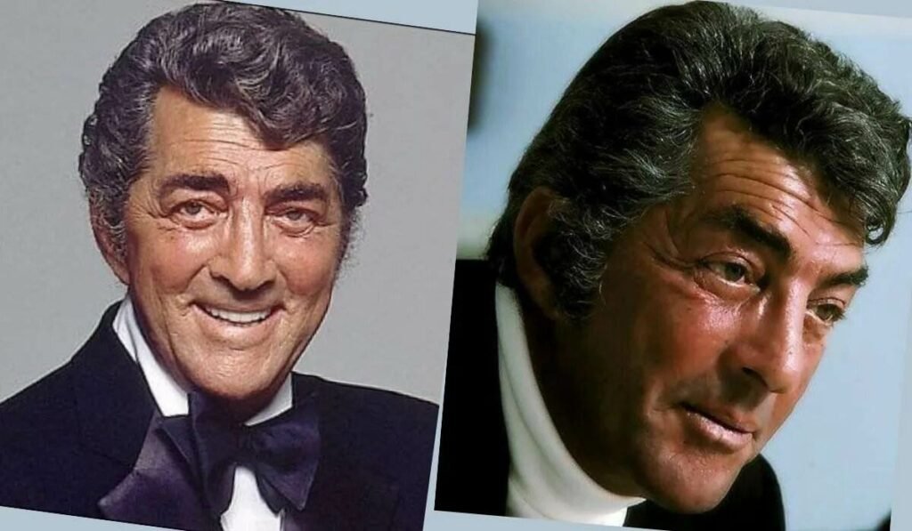 Dean Martin Hairpiece - Uncover The Truth Here!